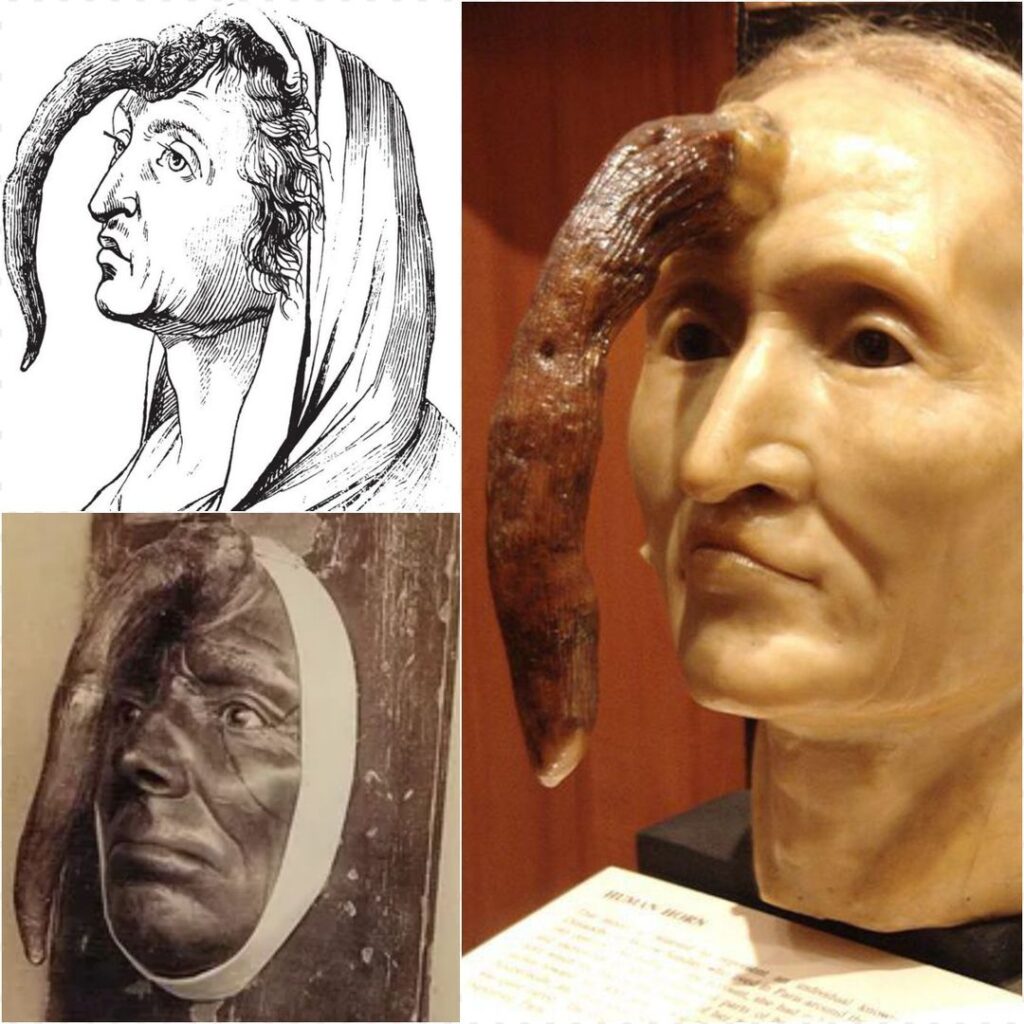 The fascinating story of Madame Dimanche, Paris’s horned woman ...